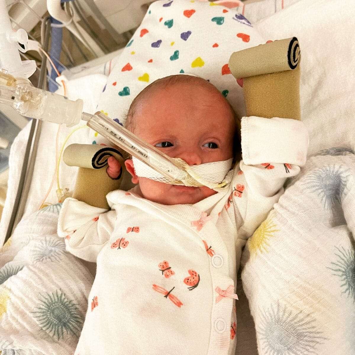 Heartbeat of Resilience: Baby Indiana's Journey with Trisomy 18 and the ...