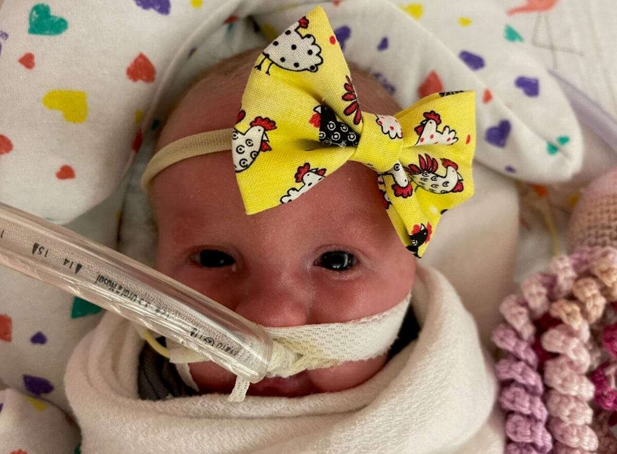 Heartbeat of Resilience: Baby Indiana's Journey with Trisomy 18 and the ...